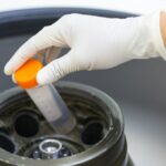 cfDNA Extraction Kit | Nonacus