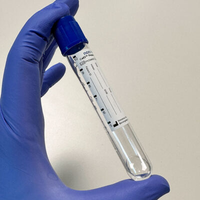Cell-Free DNA Tubes | Nonacus
